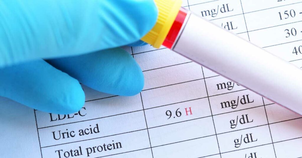 What is gout and how to treat it